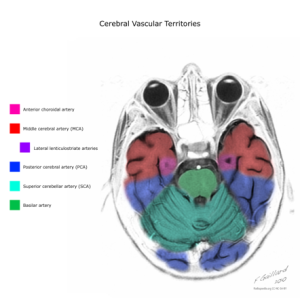 VASCULAR TERRITORIES,STROKE,CEREBELLAR,BRAIN | hubstroke.com