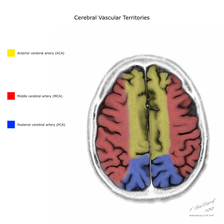 VASCULAR TERRITORIES,STROKE,CEREBELLAR,BRAIN | hubstroke.com