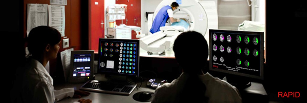 (English) RAPID thrombectomy in CT perfusion | hubstroke.com
